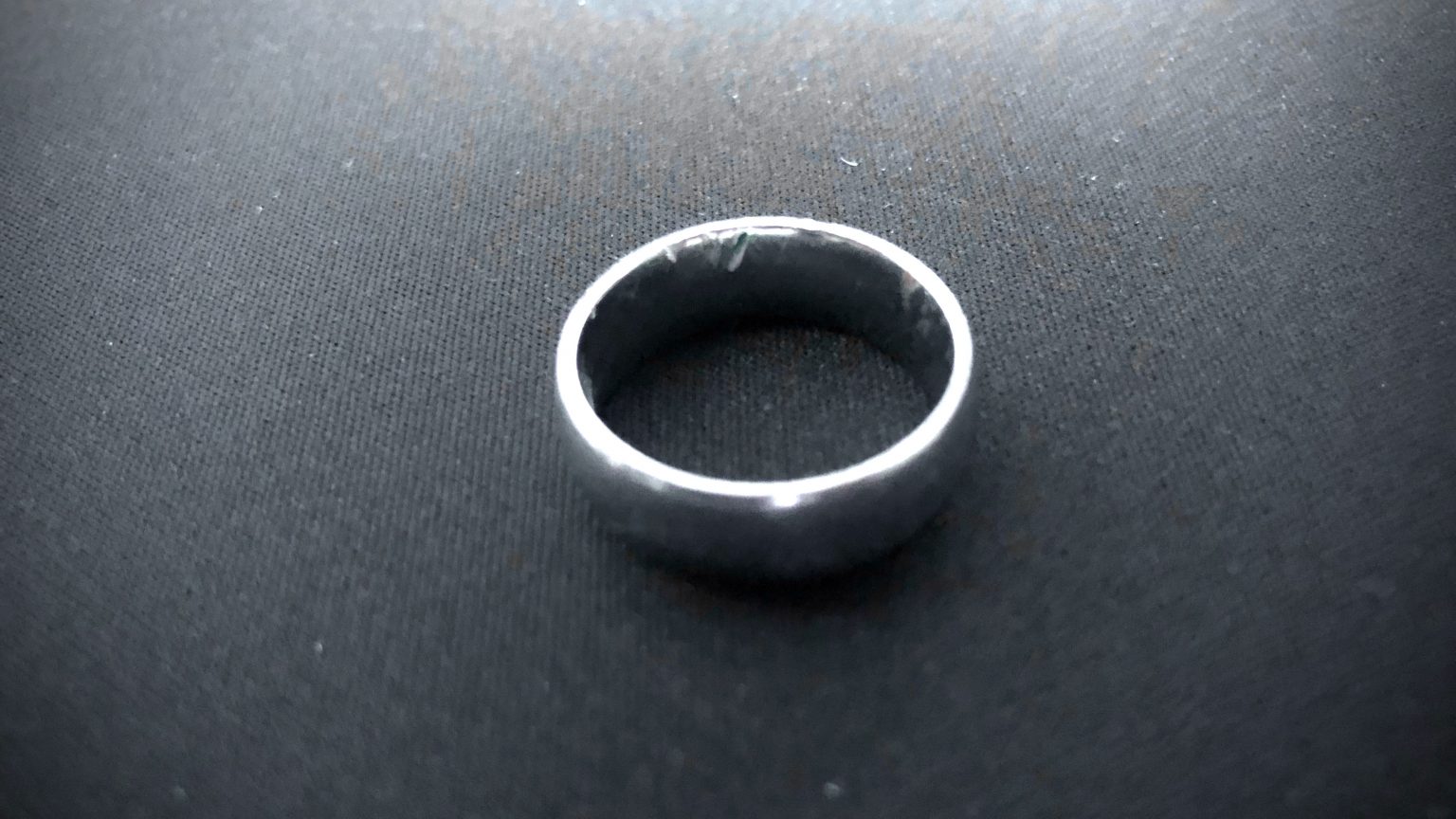 Ring avulsion — how I lost my wedding ring finger – Ben Frain