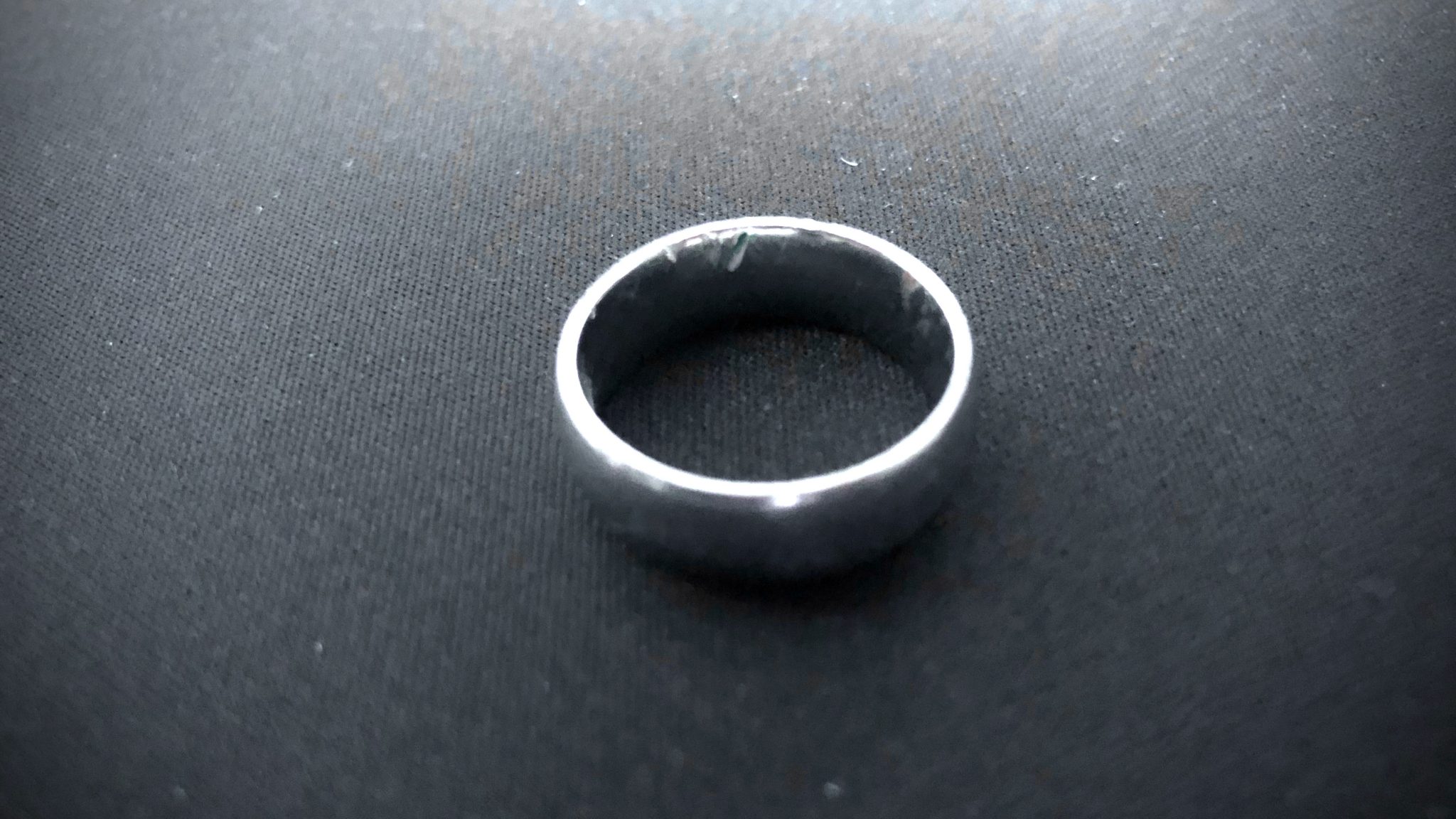 Ring avulsion — how I lost my wedding ring finger – Ben Frain